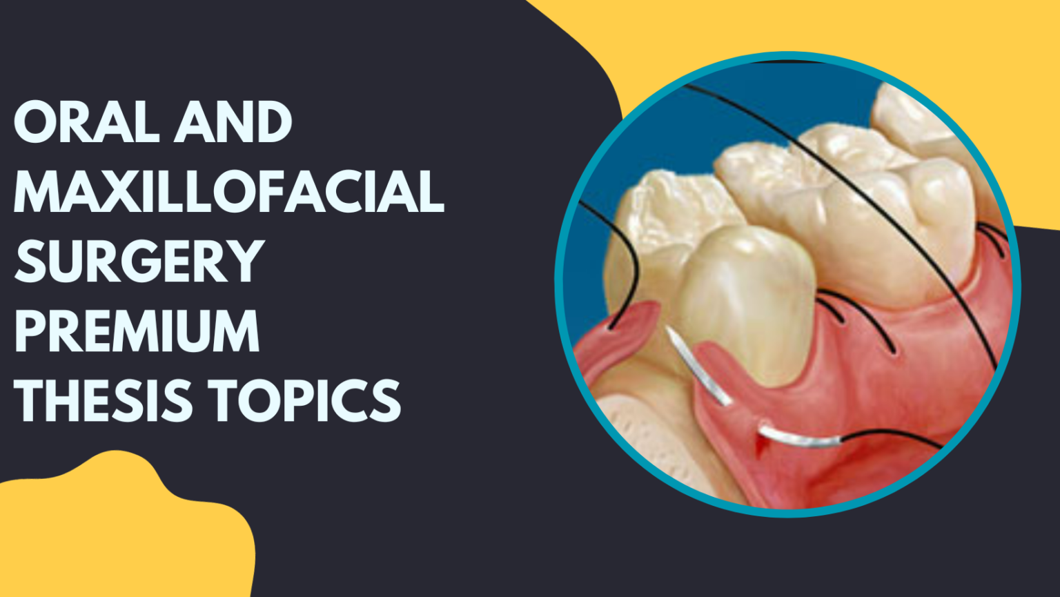 2000+ Comprehensive periodontics Thesis Topics for MDS