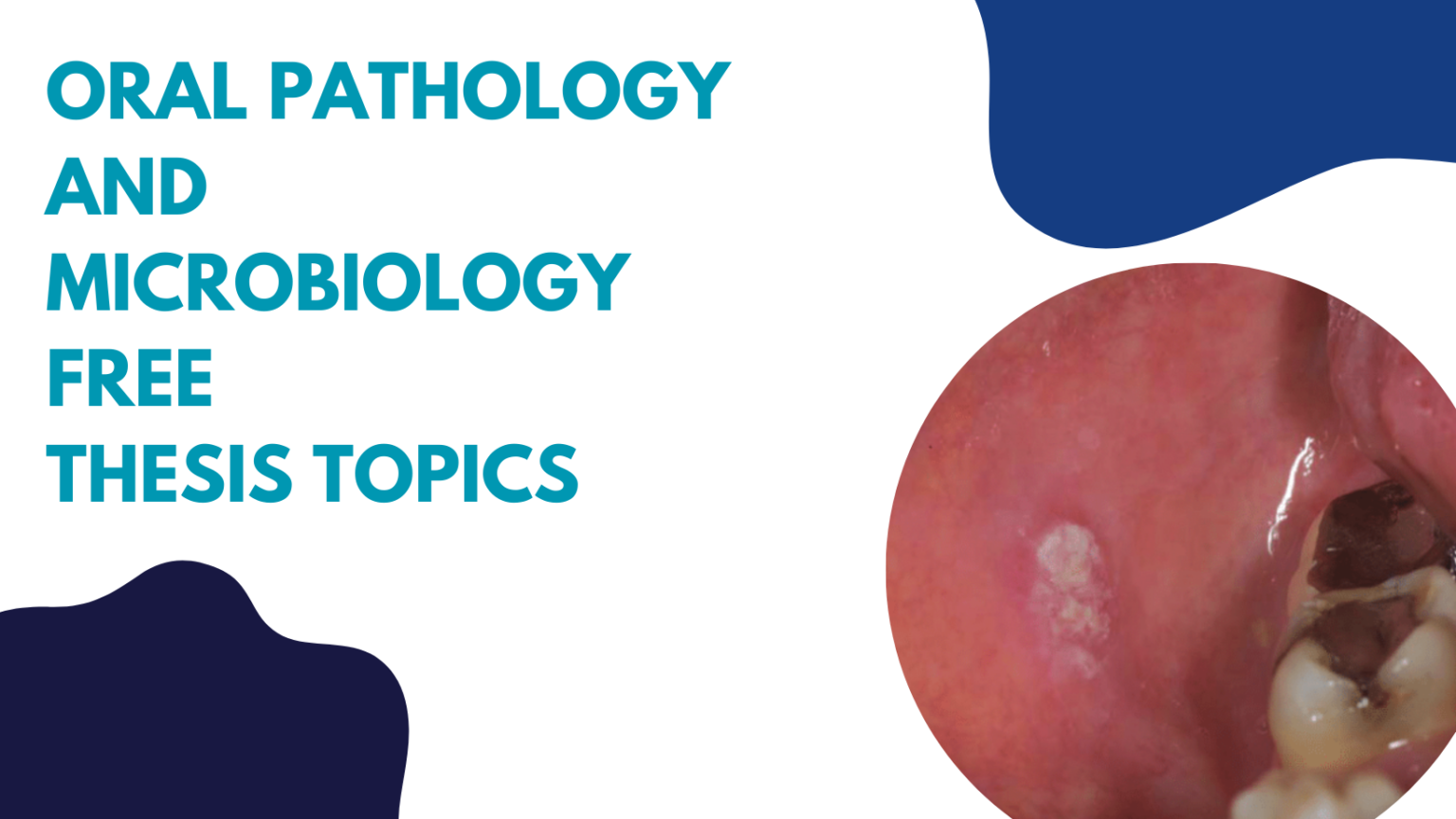 2000+ Comprehensive periodontics Thesis Topics for MDS